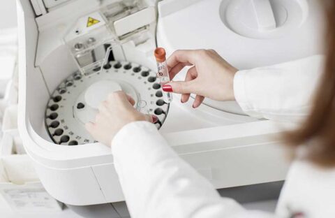 Precision Epigenomics Highlighted by Tucson News 13 for Multi-Cancer ...